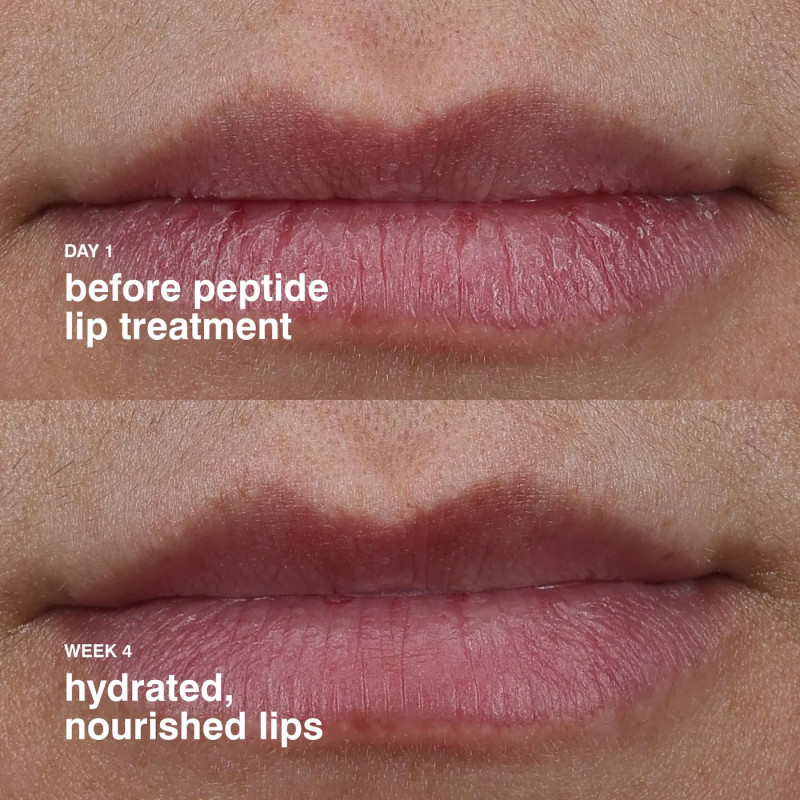 Rhode Peptide Lip Treatment